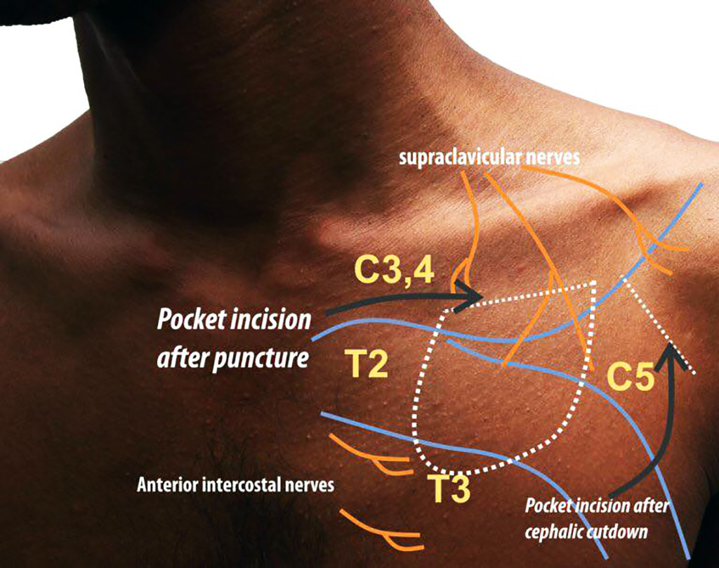 [2ページ目] 循環器について | ECG-Cafe